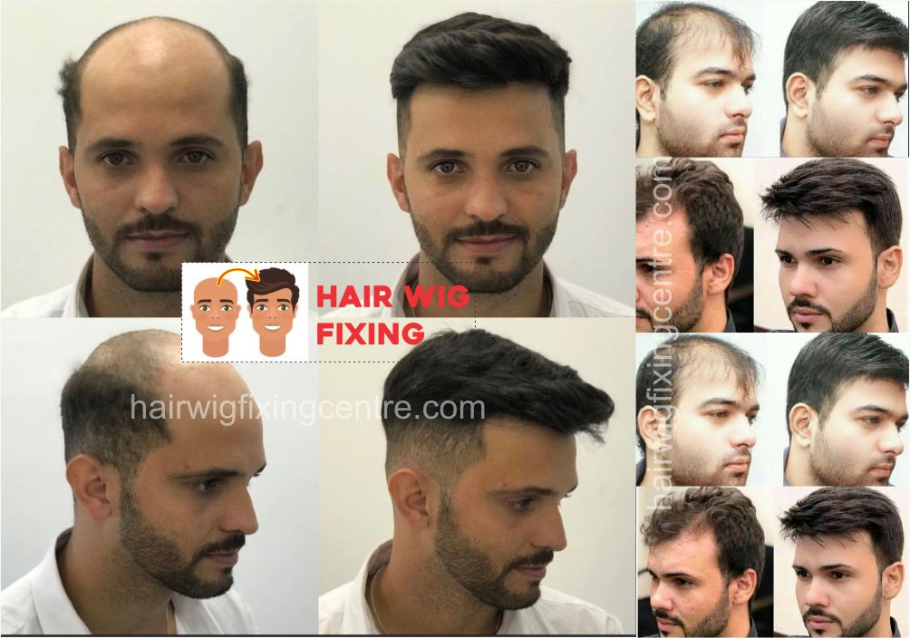 Home - Hair Wig Fixing Centre